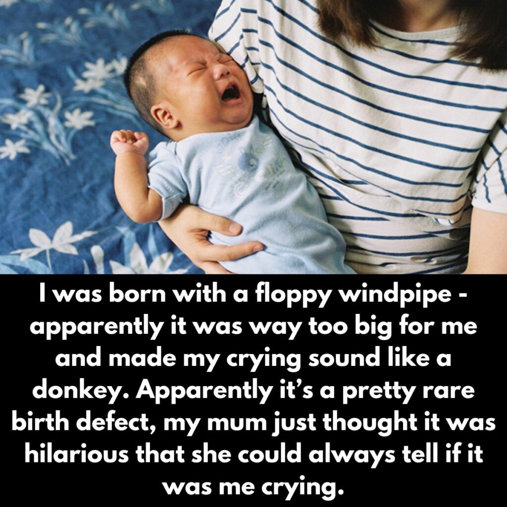 People Share the Strange and Mysterious Features of Their Bodies – Page 24